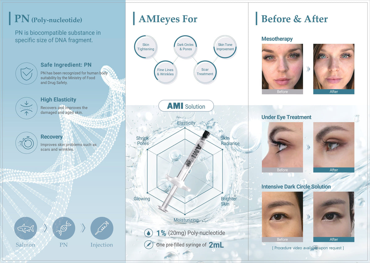 Ami Eyes Filler | Ami Eyes Dermal Filler | brunodermalfiller.com
