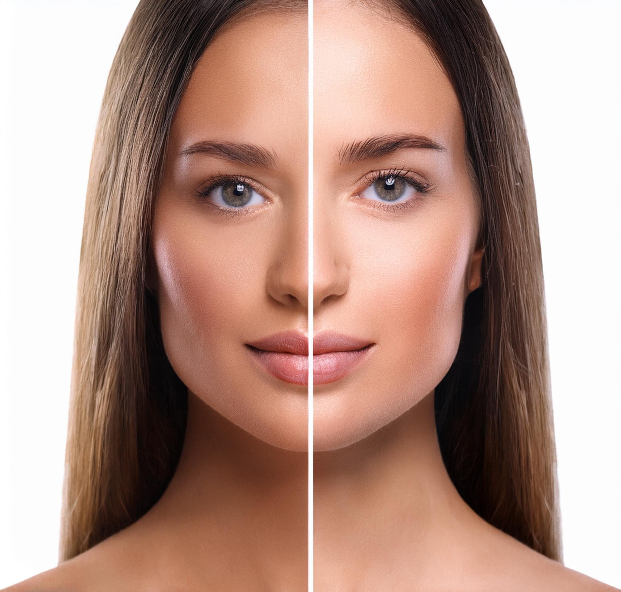 Are Dermal Fillers Permanent? Understanding the Longevity of Your Beau ...
