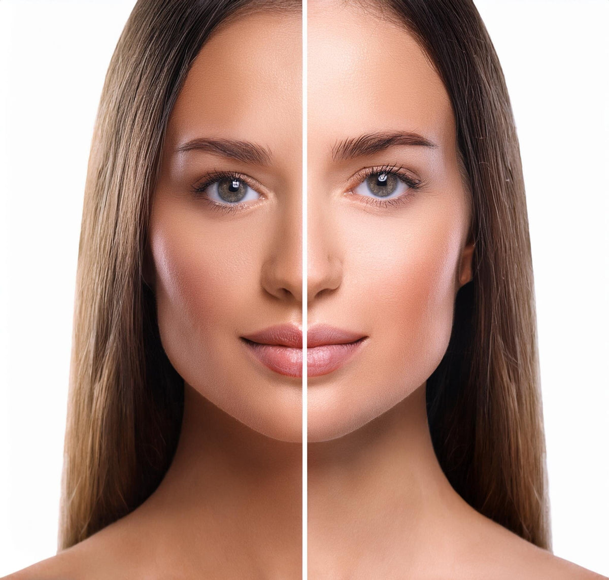 Are Dermal Fillers Permanent? Understanding the Longevity of Your Beau ...