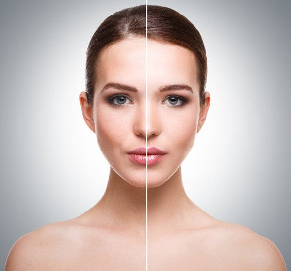 "The Ultimate Guide to Dermal Fillers: From Hyaluronic Acid to Poly-L ...