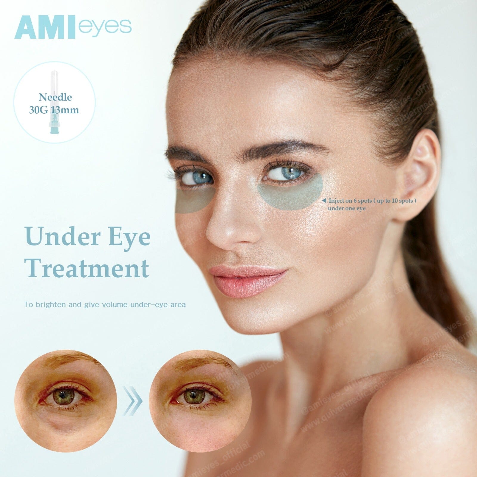 Ami Eyes Filler | Ami Eyes Dermal Filler | brunodermalfiller.com